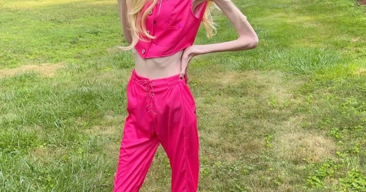 Американка з анорексією приміряла вбрання в стилі Барбі і стривожила підписників